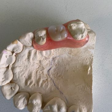 Before & After | Walkinstown Dental Studio | Dublin