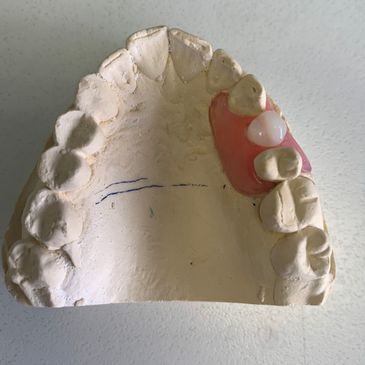 Before & After | Walkinstown Dental Studio | Dublin